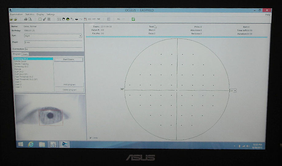 $4995 Oculus Easyfield C with laptop – Precision Equipment