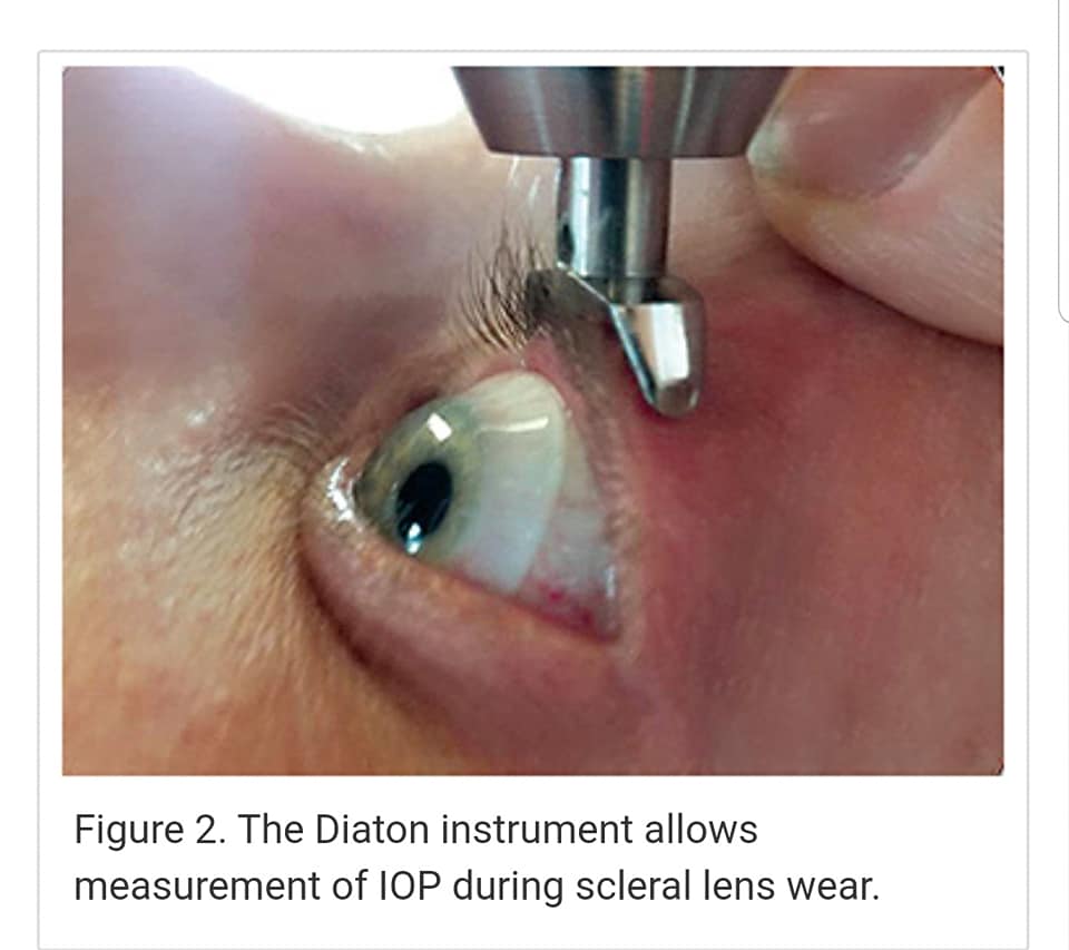 Diaton IOP Tonometer- Through Eyelid and Sclera - Refurbished ...